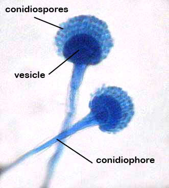 Biol 230 Lab Manual: Conidiospores of Aspergillus